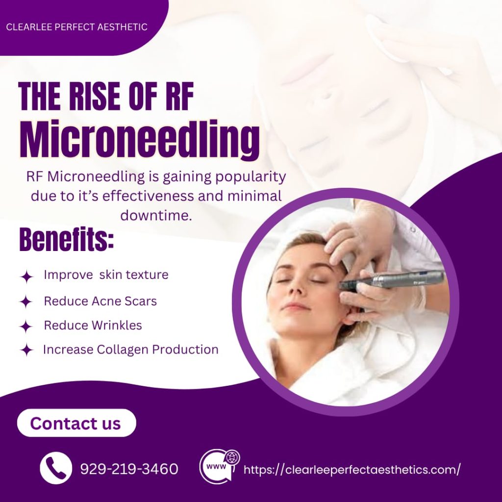 5 Big Reasons Why RF Microneedling Is the Future of Skincare